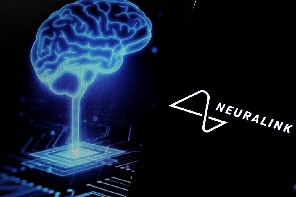Can Neuralink's First Patient Control A Computer Mouse Through Thought ...